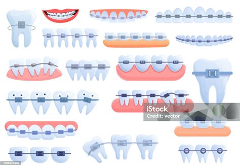 Ilustración De Conjunto De Iconos De Brackets Dentales Estilo De