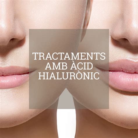 Tractaments Amb àcid Hialurònic Epidermos Institut De Dermoestètica