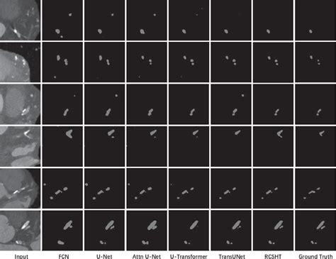 Figure 3 From A Hybrid Cross Scale Transformer Architecture For Robust Medical Image