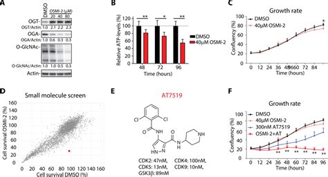 Inhibition Of O Glcnac Transferase Renders Prostate Cancer Cells