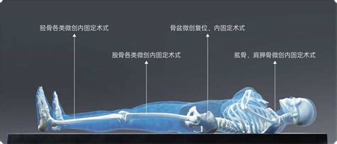 东北地区首例！holosight知见骨科创伤机器人助力吉林大学中日联谊医院完成复杂骨盆骨折手术 好医术文章 好医术 赋能医生守护生命