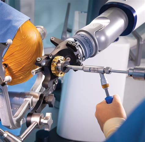 Excelsiusgps™ By Globus Medical Sdv Medical