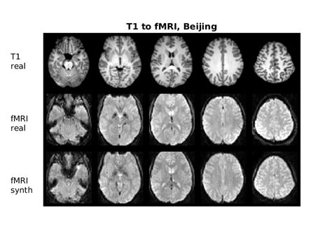 Generating Fmri Volumes From T1 Weighted Volumes Using 3d Cyclegan Deepai