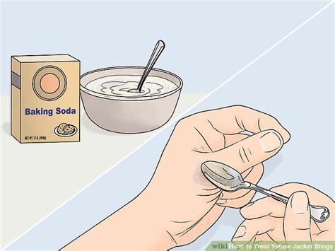 Yellow Jacket Sting Treatment What To Do For Quick Relief