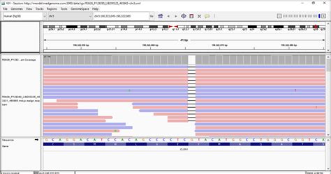 Neonatal Ichthyosis And Sclerosing Cholangitis Nisch Syndrome With A