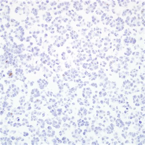 Cell Marque Hpvp16 Analyte Control