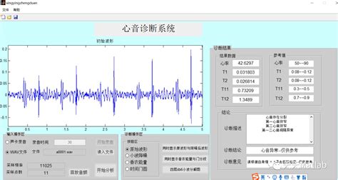 【心电信号】基于matlab实现心音诊断系统含gui心音信号分析用什么软件 Csdn博客