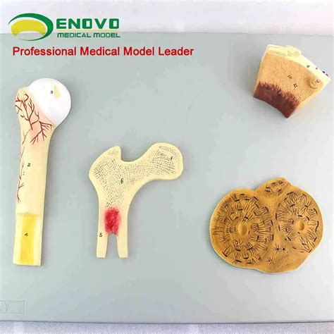 Bone Structure Model Of Vascular Cancellous Bone Compact Bone And