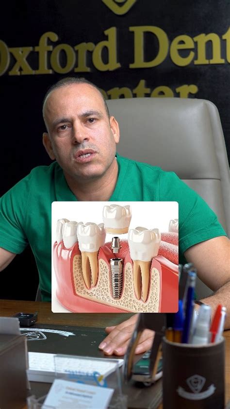 🦷 سؤال واش الفيس كايتصدى؟ الدكتور مجدوب يوضح الحقيقة العلمية حول الفيس