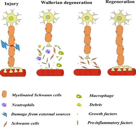 Figure 1 From Inflammation In The Peripheral Nervous System After