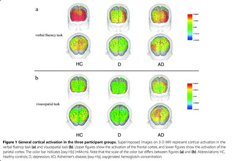 Shows The Topography Of Cortical Activation Of Each Group Cortical