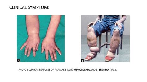 Culex Mosquitoes Systematic Classification Morphology Life Cycle