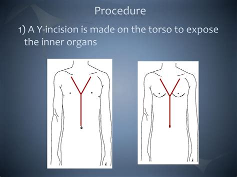 Ppt Autopsies Powerpoint Presentation Free Download Id5738704