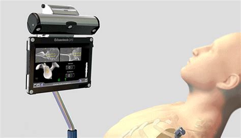 Gps Shoulder And Equinoxe Planning App Exactech