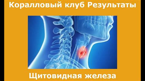 Коралловый Клуб Результаты Щитовидная железа - YouTube