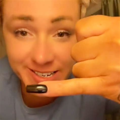 Smartphone Users Warned Of Developing ‘iphone Finger From Spending Too