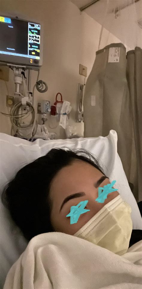 Scabs Still Attached After Days Is This Normal I Keep On Reading They Are Meant To Fall