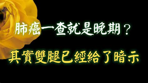 肺癌一查就是晚期？其實雙腿已經給了暗示，只是被你忽視了！盡早篩查才好 Youtube