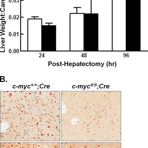 Hepatic C Myc Deletion In C Mycflflalb Cre Expressing Mice A