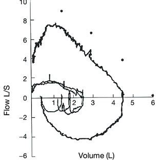 Flow Volume Loop Is Demonstrating Fixed Upper Airway Obstruction Inner Download Scientific
