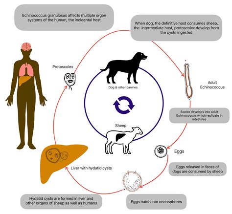 A Narrative Review Of The Neurological Manifestations Associated With