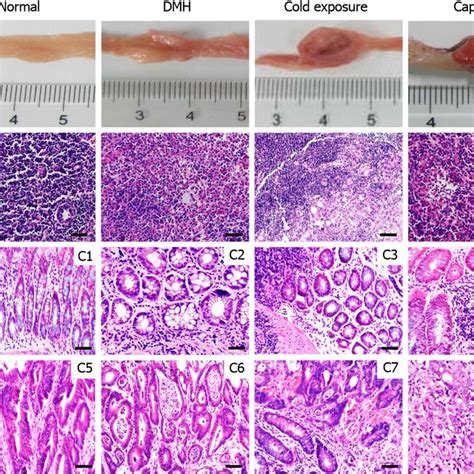 Pathological Observation And Lymph Node Metastases Of Different Groups Download Scientific