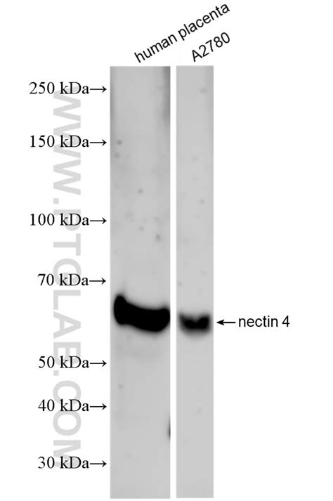 Nectin 4 Pvrl4 Antibody 83223 6 Rr Proteintech