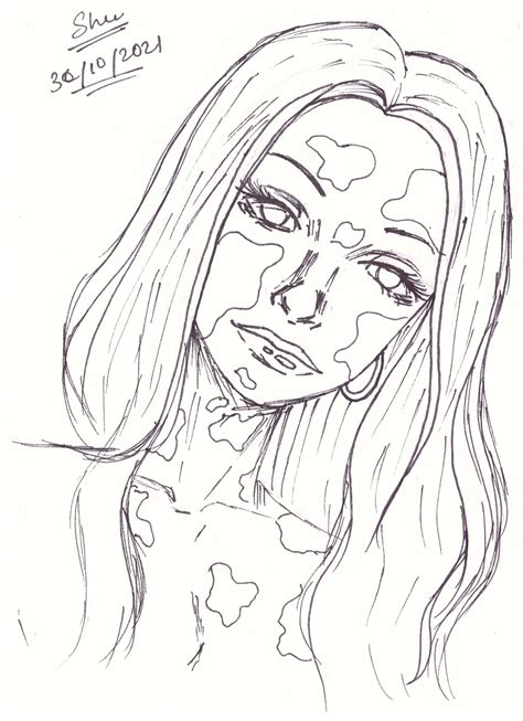 Vitiligo Girl Sketch By Shu5544 On Deviantart