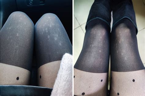 Появились пятна на колготках после дождя Объяснение производителя возмутило женщину
