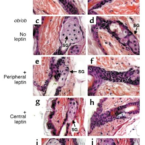 Upregulation Of Dgat2 In The Skin Of Obob Mice A Mrna Expression Of