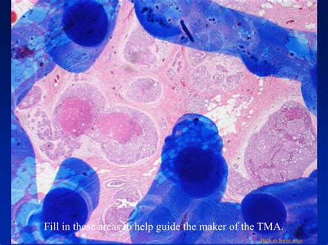 Ppt Requirements For Good Tissue Microarray Tma Results Powerpoint Presentation Id 4513355