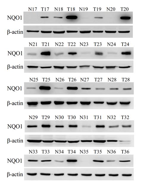 Cpsf6 Links Alternative Polyadenylation To Metabolism Adaption In