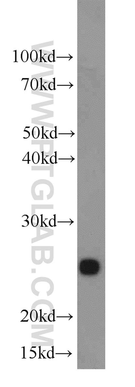 Sigmar1 Rabbit Anti Human Mouse Rat Polyclonal Proteintech 150 μl