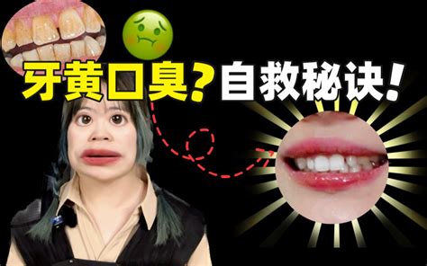 牙黄口臭怎么刷牙都不见效？亲测有效！告诉你解决办法！ 爱吃草莓的加菲酱 爱吃草莓的加菲酱 哔哩哔哩视频