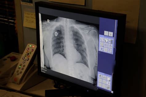 Modern Radiology Room With A Black Computer Monitor With A Diagnostic X