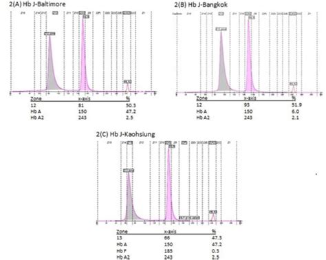 Capillary Zone Chromatogram Migration Patterns Zone
