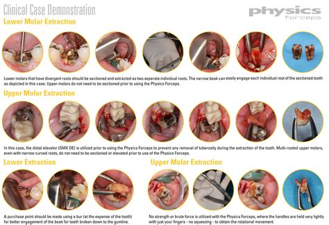 Physics Forceps Standard Series