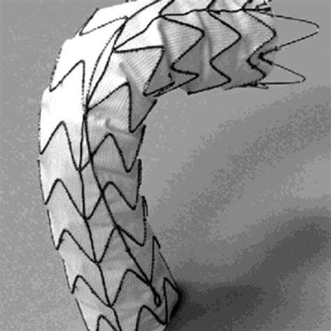 Gore Ctag The Evolution Of Gores Tevar Device From The Original Gore