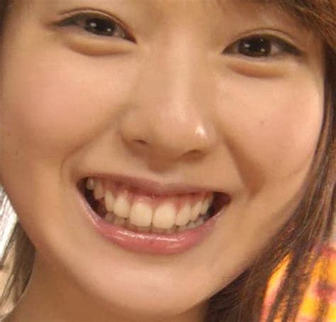 戸田恵梨香さんの前歯と歯茎を評論（歯茎整形？） 僕の審美歯科ガイド｜前歯の差し歯治療で後悔しないための情報源