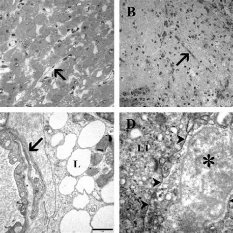 Localization of laminin α4 A and B and laminin β1 C F in human