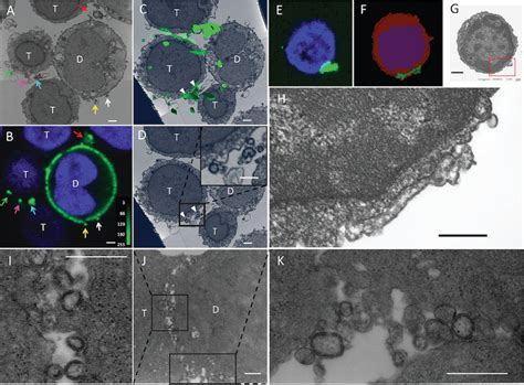 Large Puncta Transferred To Target Cells Correlate With Electron Dense Download Scientific
