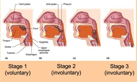 Dysphagia Flashcards Quizlet