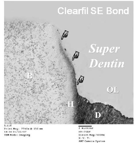 Tem Image Of The Interface Between A Two Step Self Etch Adhesive System Download Scientific