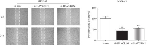 Reduction Of Havcr1 Attenuated The Migration And Invasion Of Gac Cells