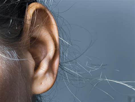 Tinnitus After Ear Wax Removal How Long It Takes