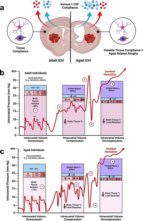 A Summary Of Theorized Tissue Compliance Dynamics That Take Place With