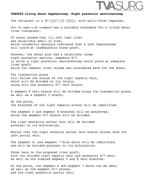 Tvasurg Process The Surgical Script Tvasurg The Toronto Video