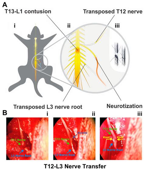 Cells Free Full Text T12 L3 Nerve Transfer Induced Locomotor