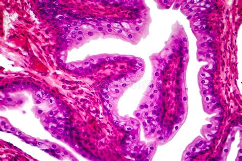 Transitional Epithelium