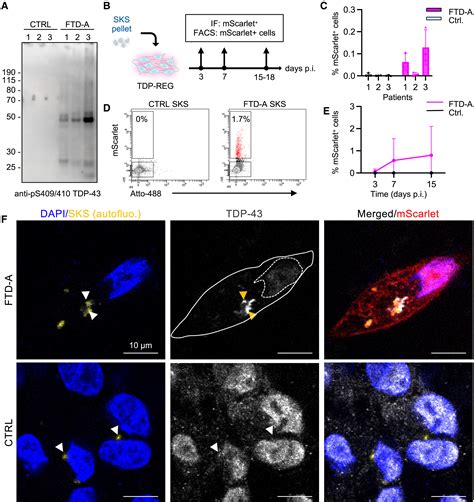 Seeded Aggregation Of Tdp 43 Induces Its Loss Of Function And Reveals Early Pathological